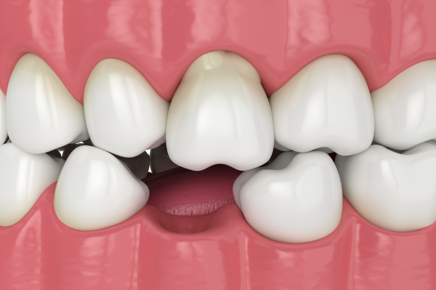Dental Emergency? 5 Tips to Save Your Teeth Guide by Alpha Dental Clinic