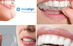 Dentist Montreal | Dentiste Brossard | Alpha Seaforth Clinique Dentaire